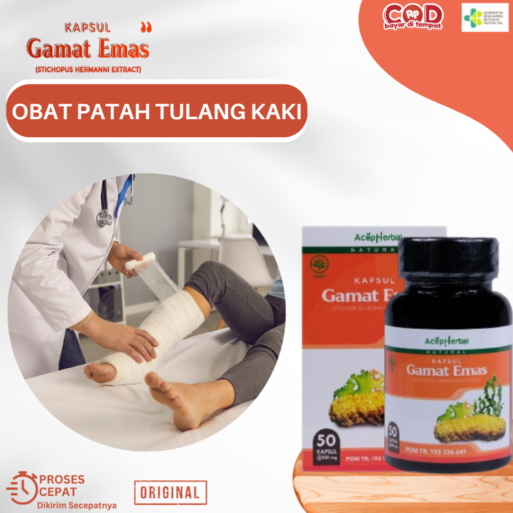 Jual Obat Patah Tulang Kaki, Obat Tulang Retak, Obat Patah Tulang Dan ...