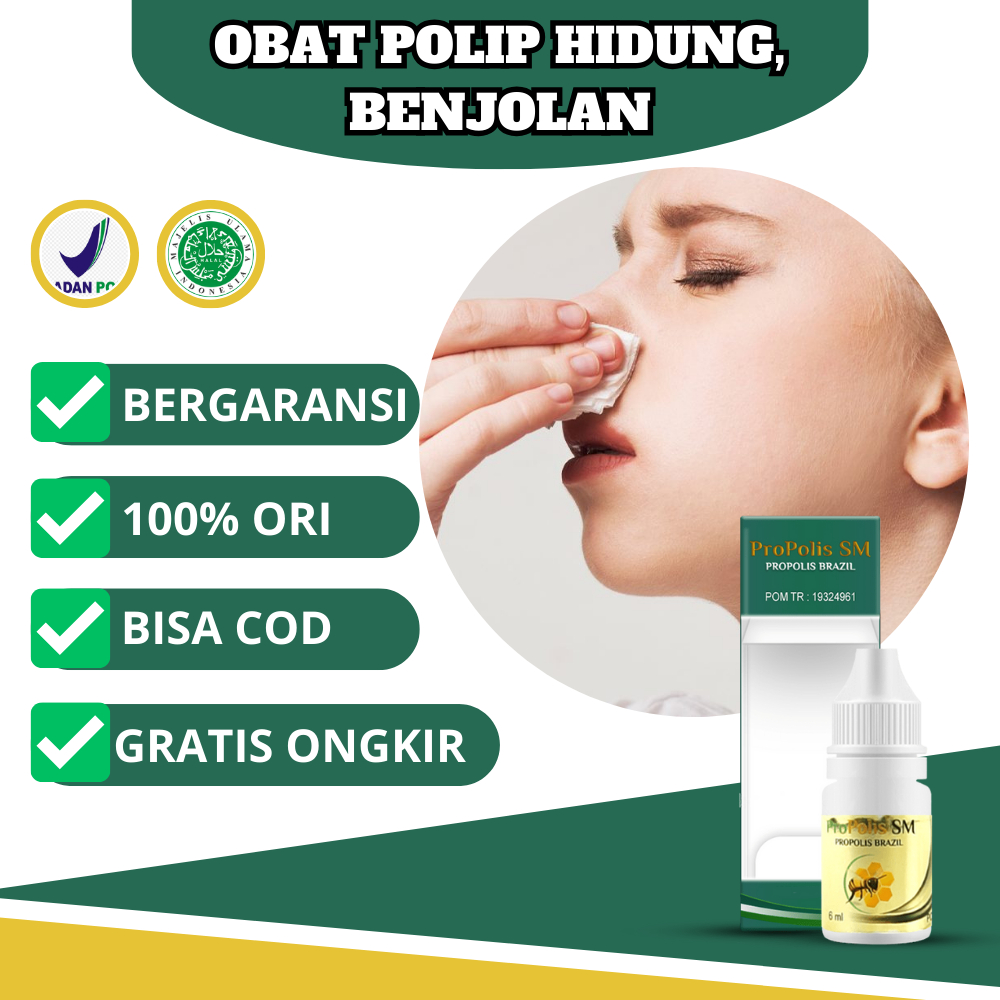 Jual Propolis Sm Brazil- Obat Polip Hidung, Keluar Cairan Bau Busuk ...