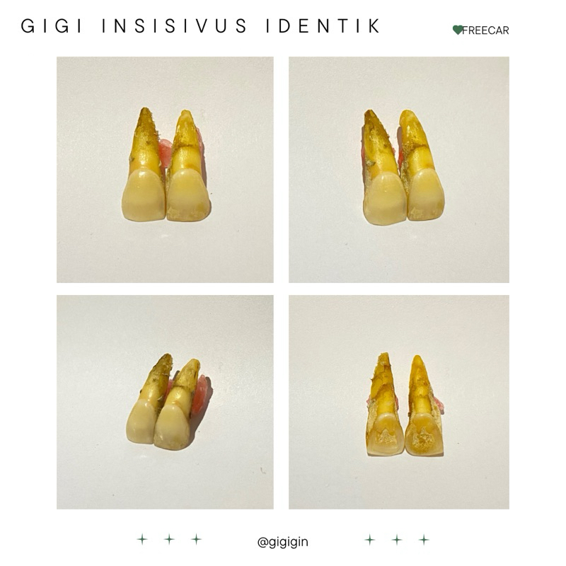 Jual Gigi Insisivus Identik (Ready) untuk Praktikum, Skills Lab dan Uji ...