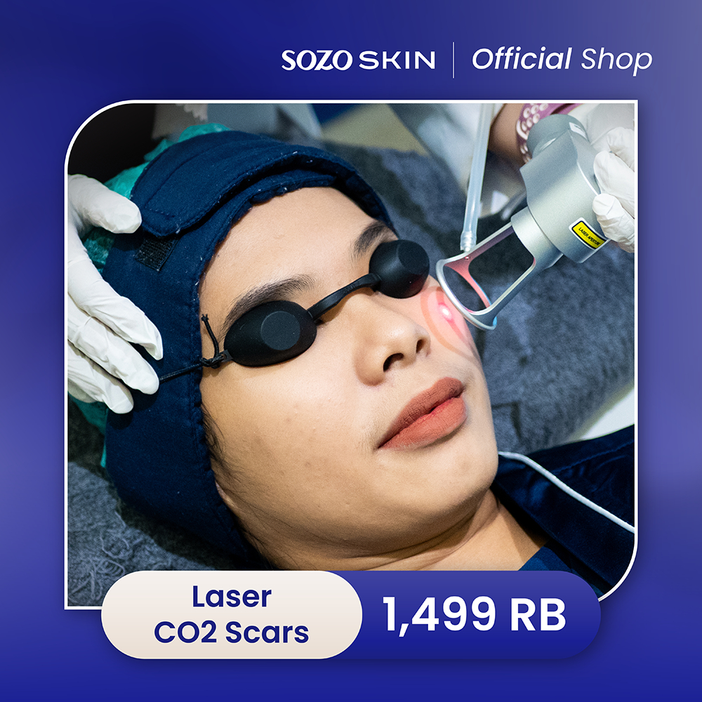 Jual SOZO SKIN Laser CO2 | Shopee Indonesia
