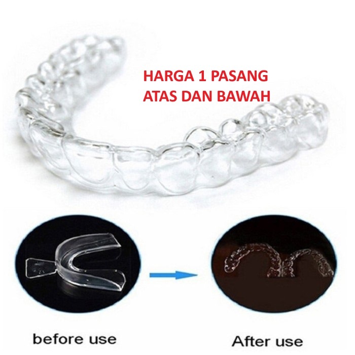 Jual SEPASANG PELINDUNG GIGI THERMOFORM Pelindung guard gigi Bruxism ...