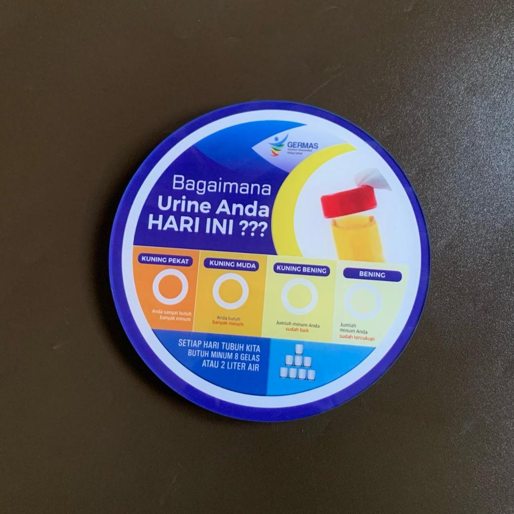 Jual Papan Akrilik Indikator Urine | Akrilik Kesehatan | Acrylic Apotek ...