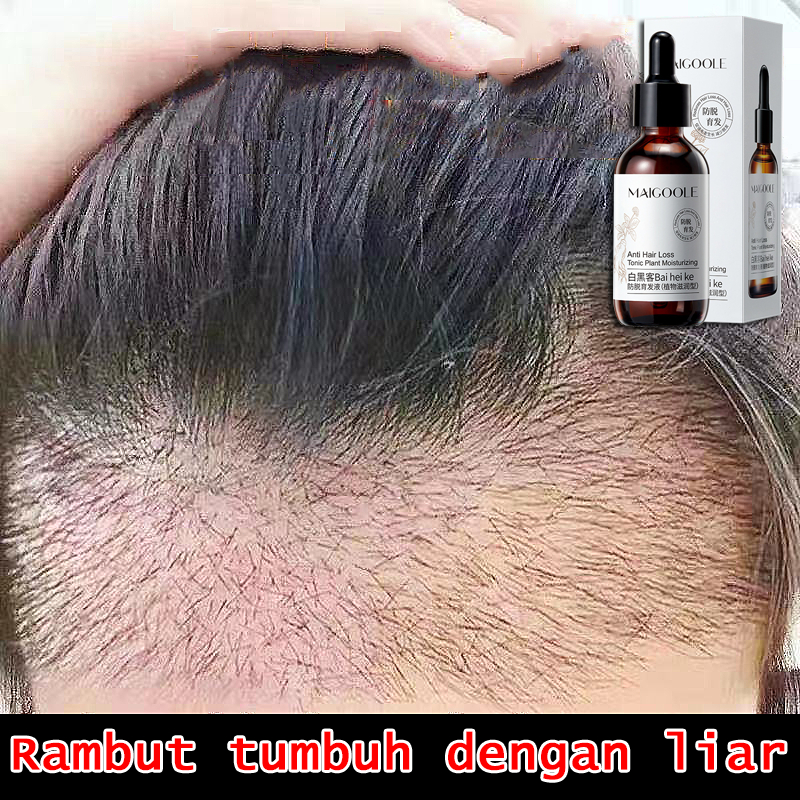 Jual Penumbuh rambut rontok Serum Penumbuh Rambut Anti Botak Penumbuh ...