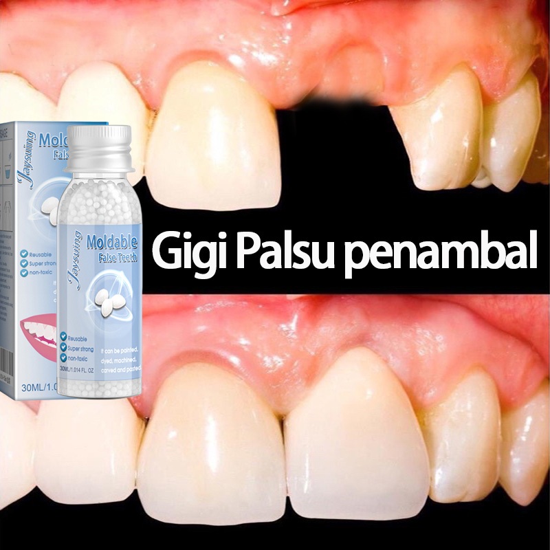 Jual Gigi Palsu Penambal gigi berlubang Gigi palsu asli dokter permanen Tambalan gigi lem gigi ...