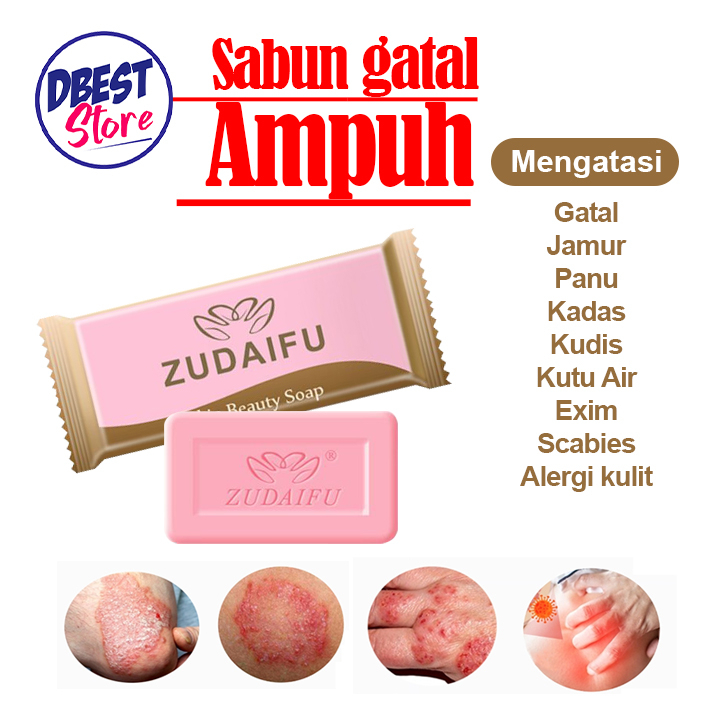 Jual Sabun Gatal Zudaifu 7gr Sabun Belerang Atasi Kulit Gatal Jamur ...