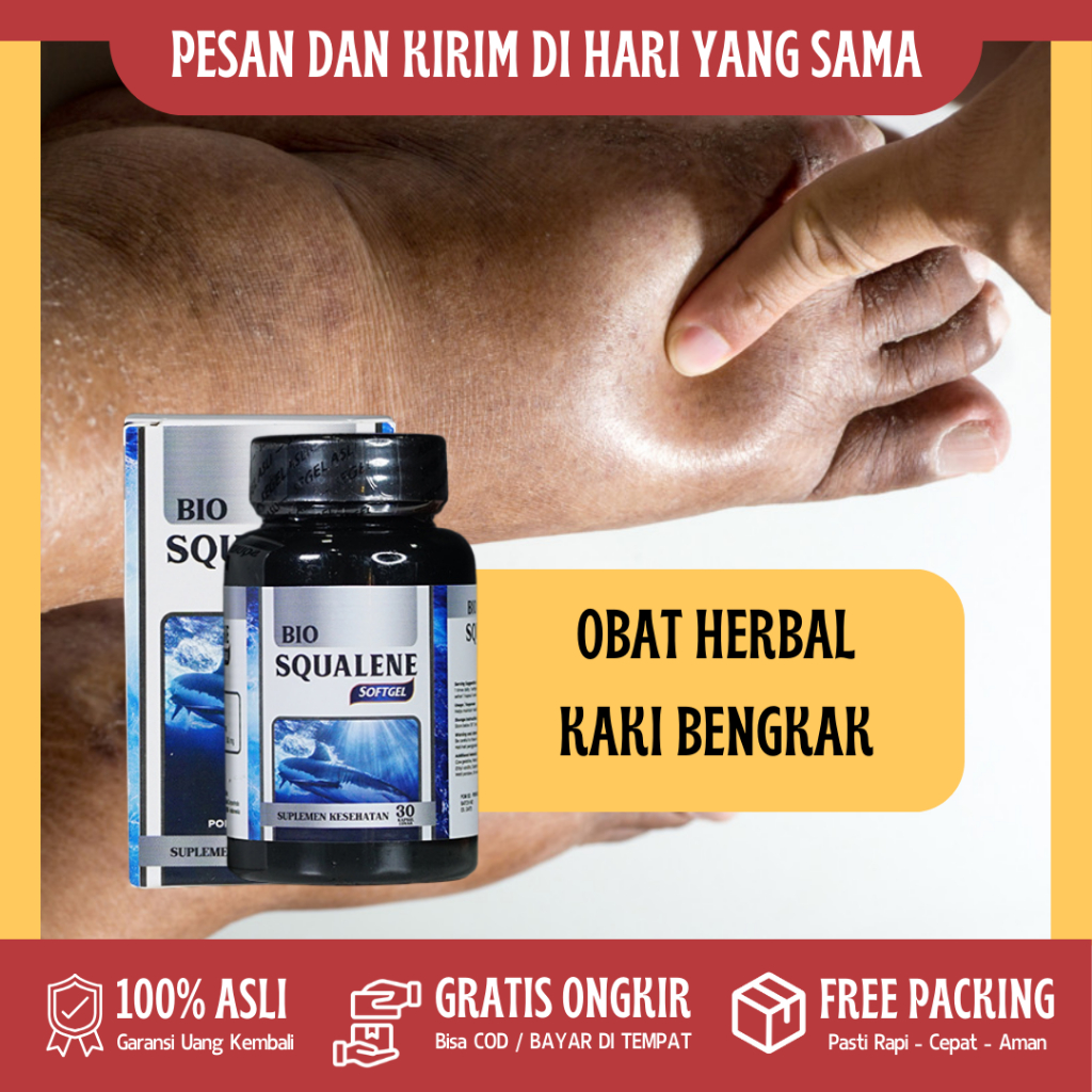 Jual Obat Kaki Bengkak Penumpukan Cairan, Obat Edema Kaki, Obat Kaki ...