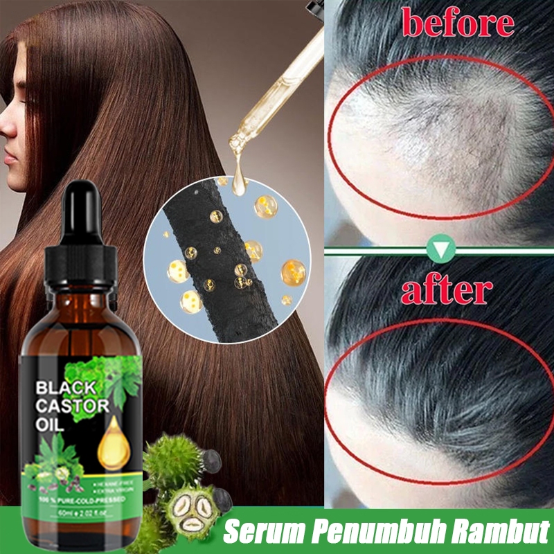 Jual minyak jarak obat penumbuh rambut serum rambut rontok castor oil ...