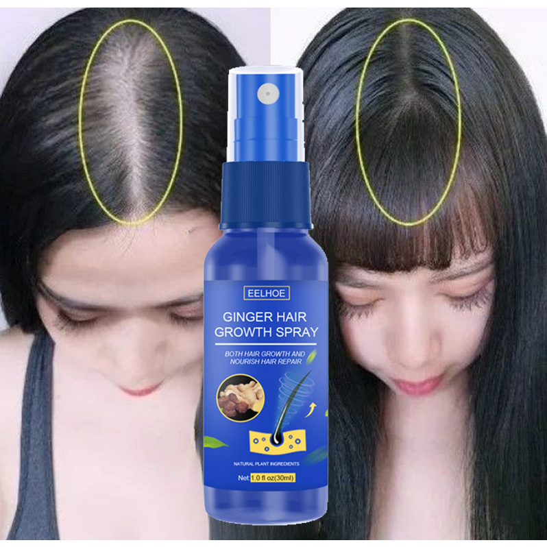 Jual Hair Growth Spray PENUMBUH RAMBUT Cairan Serum Penumbuh Rambut ...