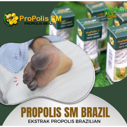 Jual Obat Penghilang jari kaki menghitam karena diabetes, kulit jari ...