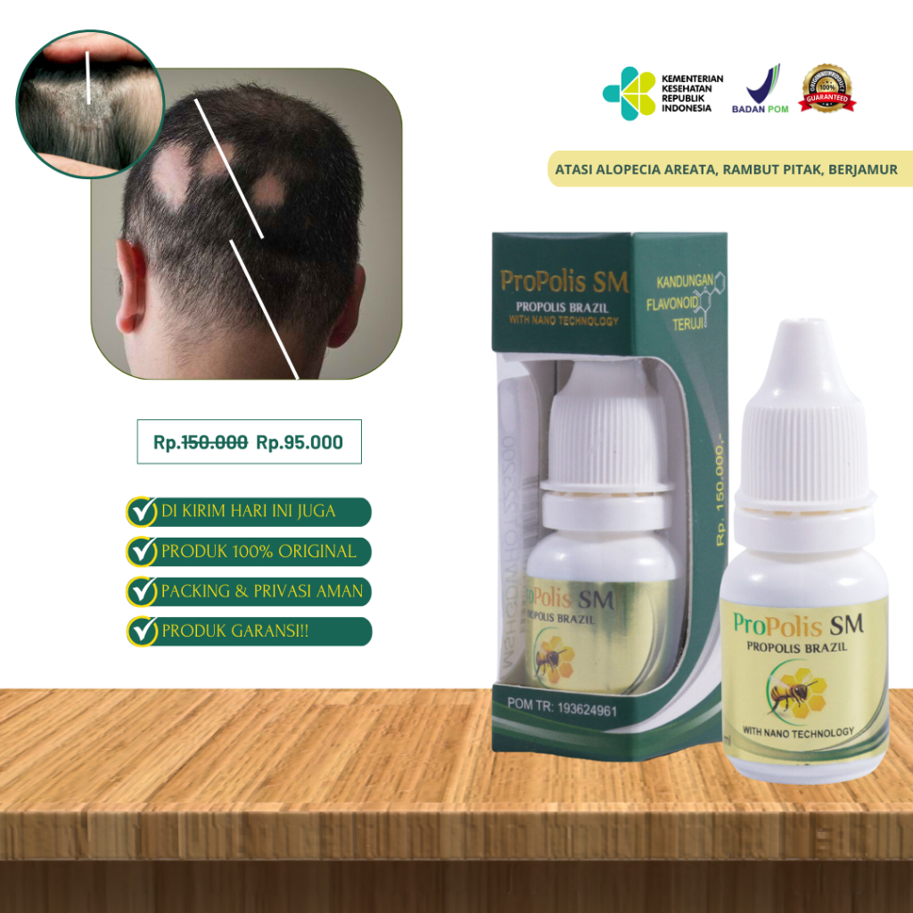 Jual Obat Penumbuh Rambut, Penumbuh Rambut Cepat Serum Penumbuh Rambut ...