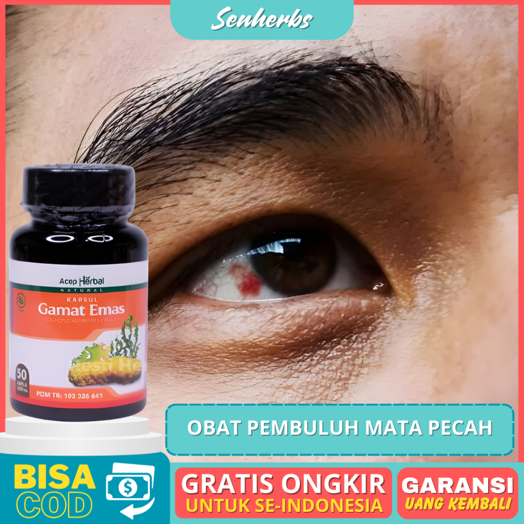 Jual Obat Pembuluh Darah Di Mata Pecah Untuk Mata Mata Berdarah Saraf ...