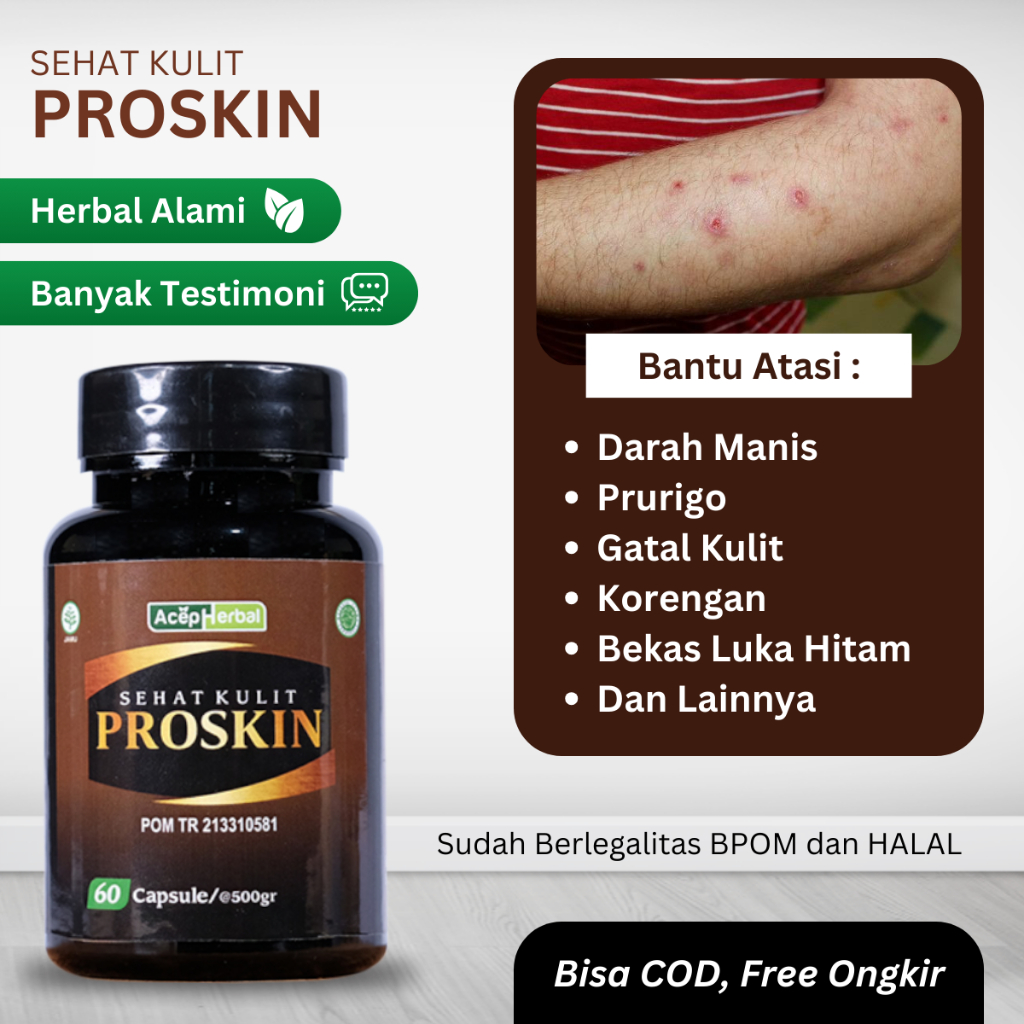 Jual Obat Herbal Darah Manis, Prurigo, Gatal Darah Manis, Koreng ...
