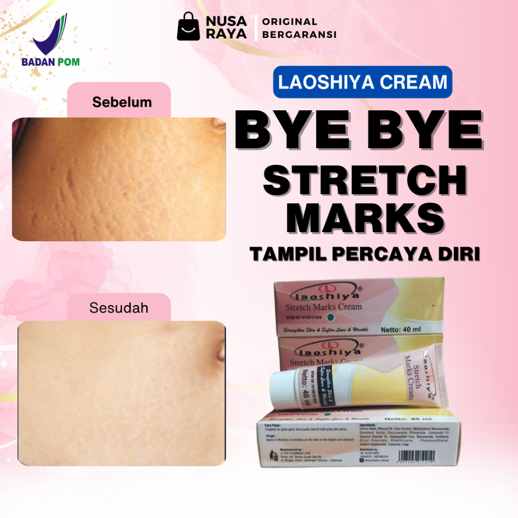 Jual Laoshiya Cream Stretchmarks Penghilang Strech Mark Stretch Mark ...