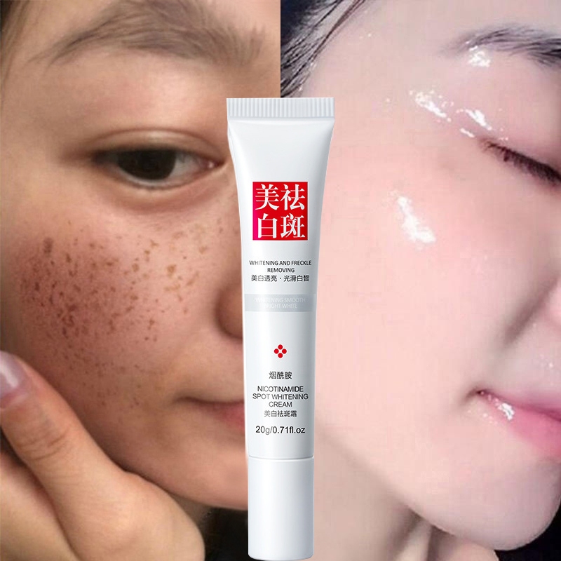 Jual Cream penghilang flek hitam whitening Krim anti bintik dan pemutih 20g Efektif ...