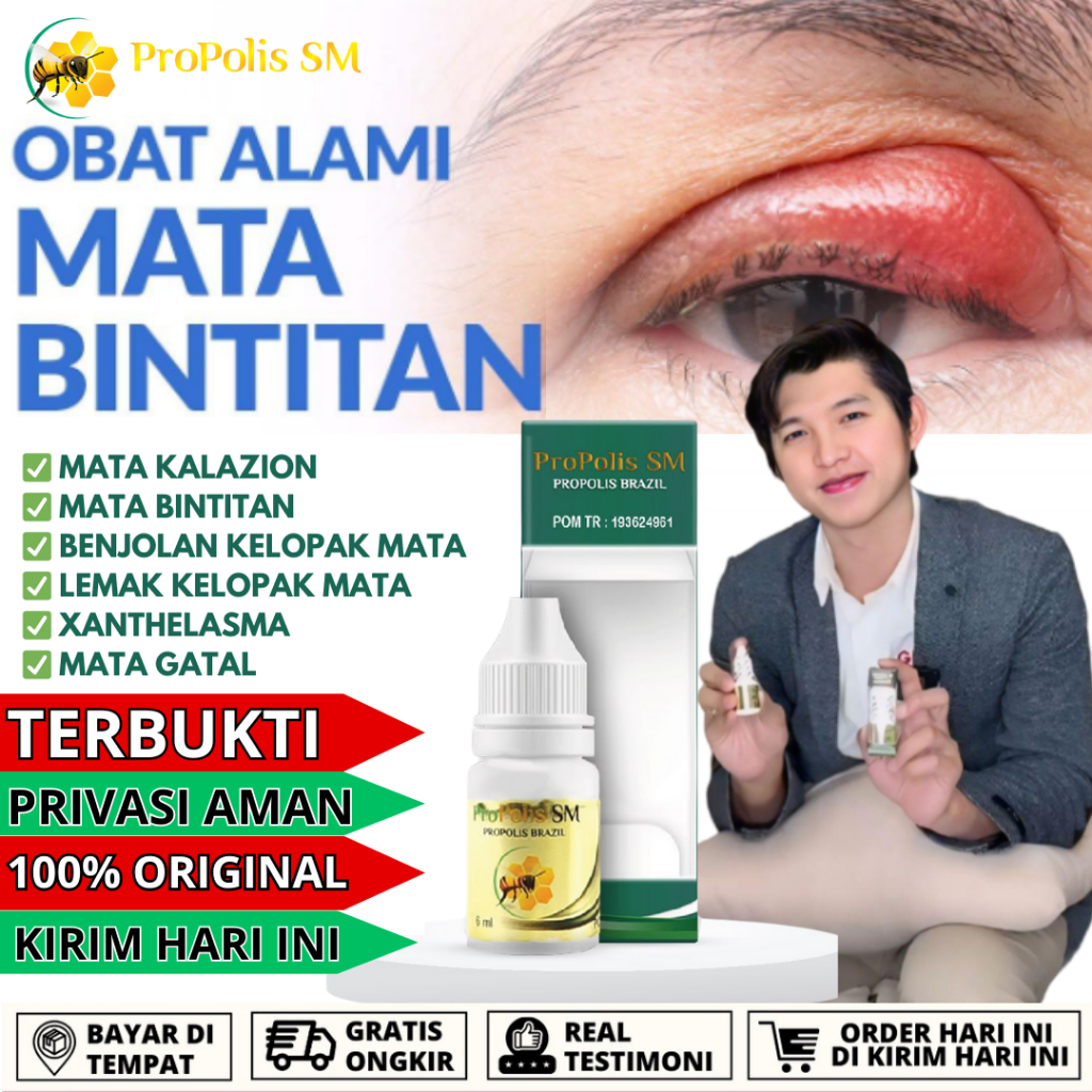 Jual Obat Mata Bintitan Benjolan di Kelopak Mata Benjolan Kalazion Obat ...