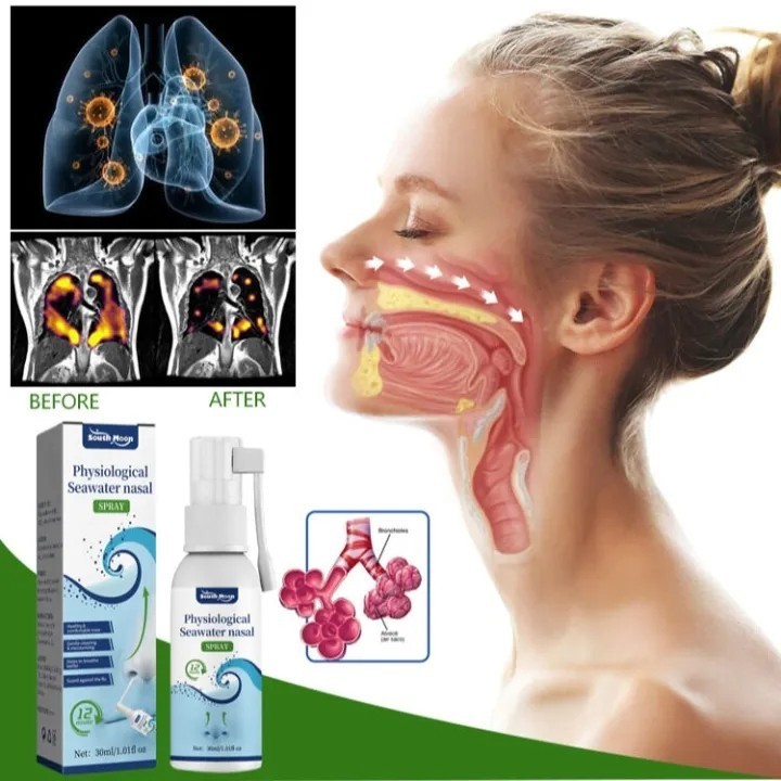 Jual Obat Semprot Sinusitis Obat Sinusitis Semprotan Hidung Paling ...