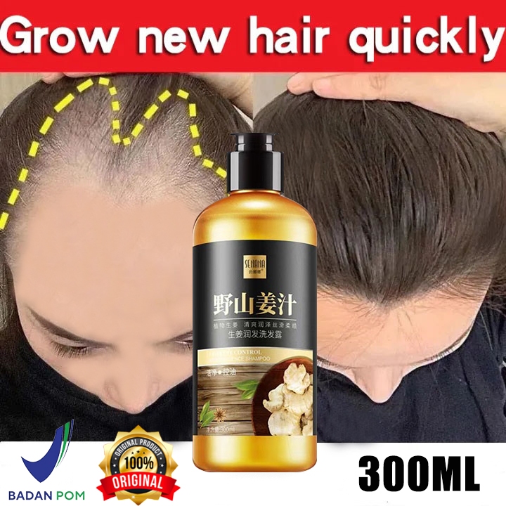 Jual 300ml Shampo Penumbuh Rambut Cepat Ginger Shampoo Original pertumbuhan rambut Pengendalian ...