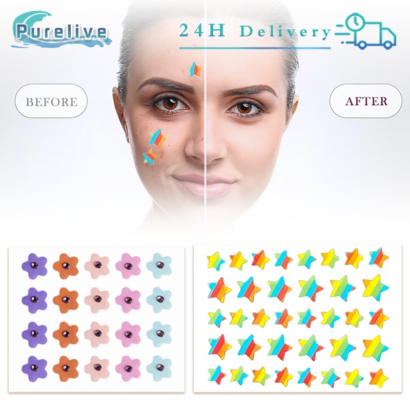Jual Acne Patch Flower/Star Acne Pimple Patch Sticker Jerawat Lucu ...