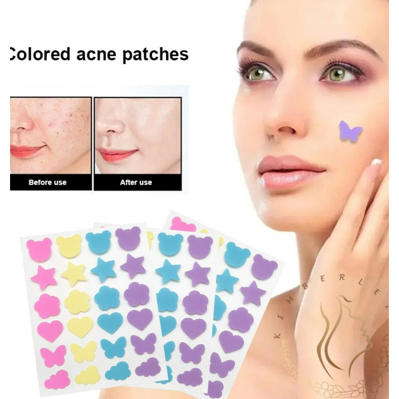 Jual Acne Patch Bentuk Lucu Sticker Jerawat Motif Warna Warni Acne ...
