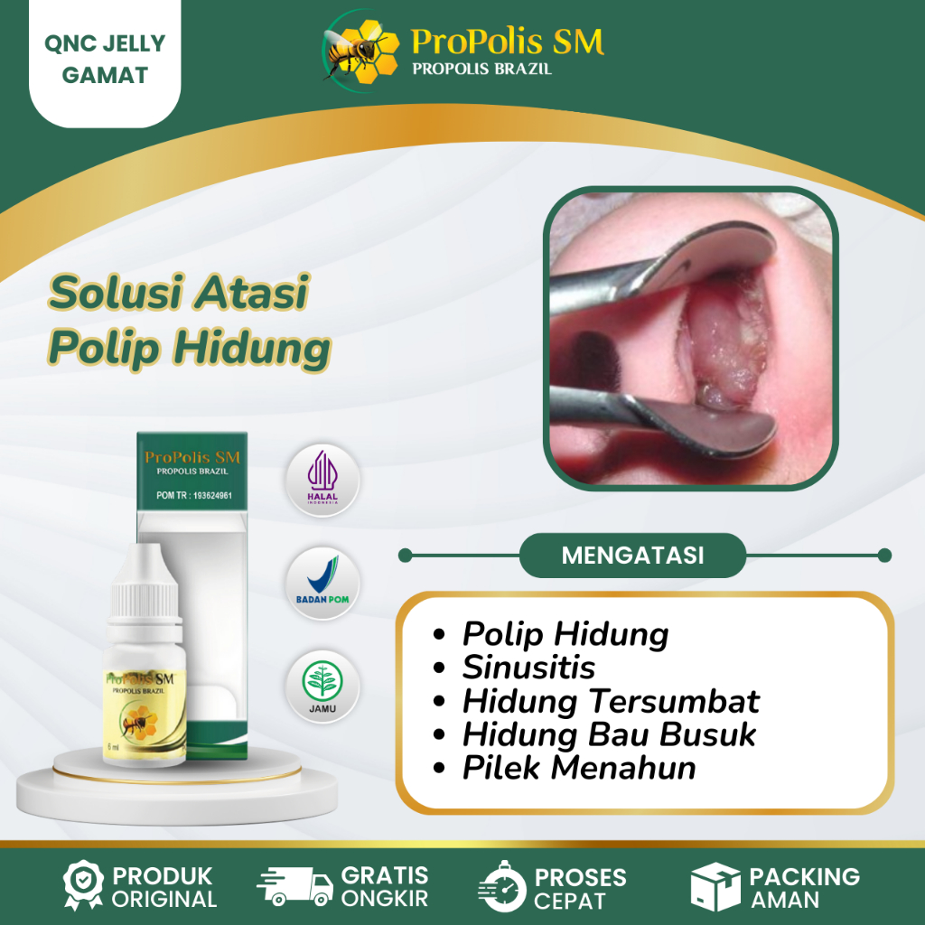 Jual Obat Polip Hidung, Sinusitis Kronis, Radang Polip Hidung, Rhinitis Akut, Gurah Sinus, Pilek ...
