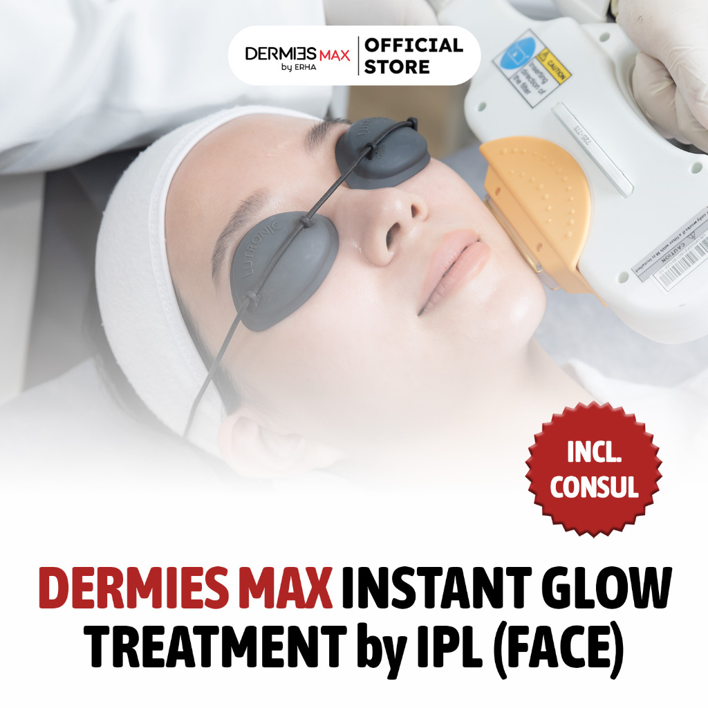 Jual Dermies Max Instant Glow Treatment by IPL (Face) | Shopee Indonesia