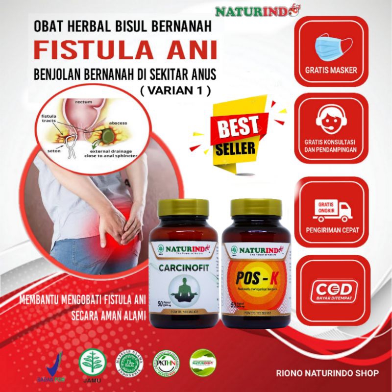 Jual Obat Fistula Ani Naturindo Obat Vistula Ani Obat Abses parianal ...