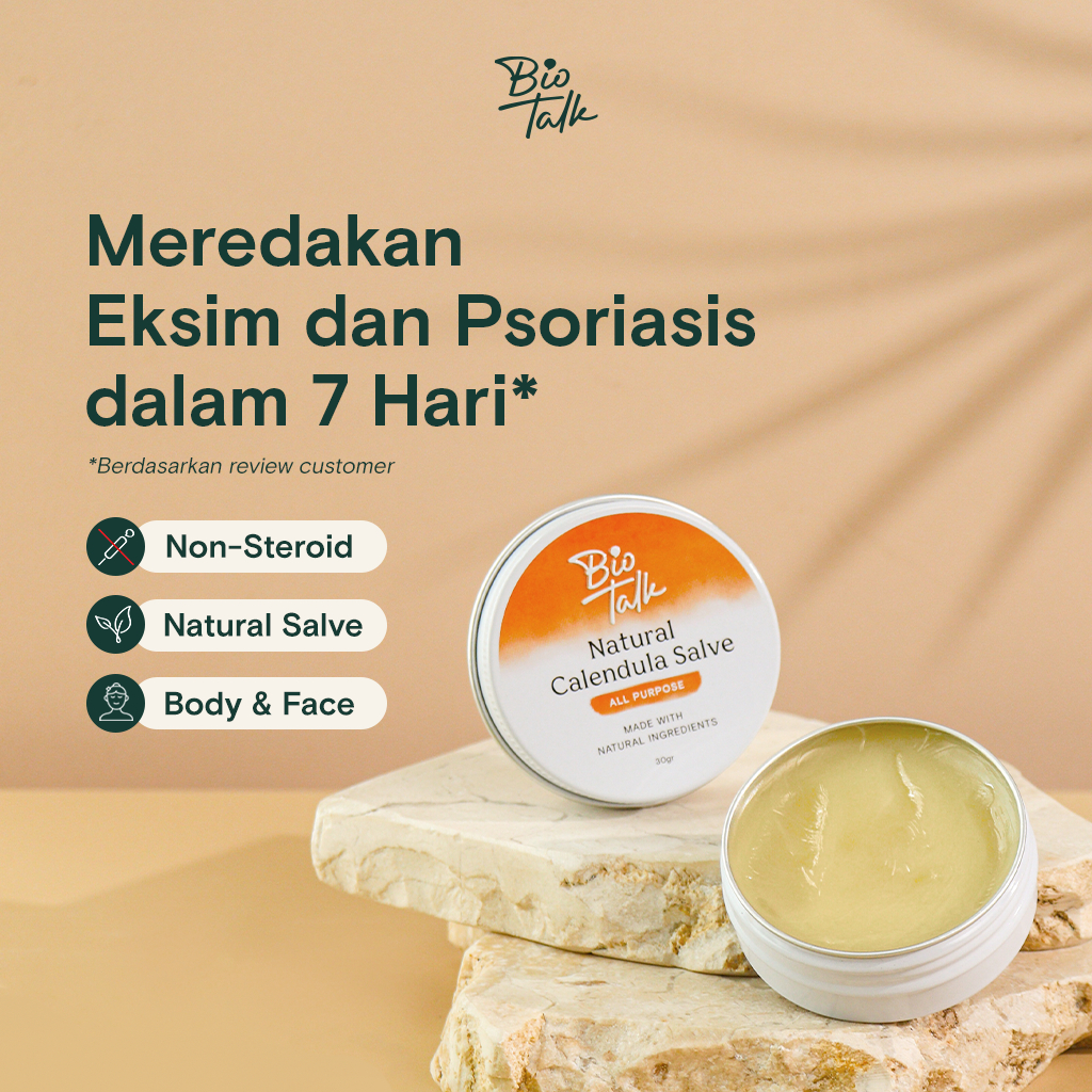 Jual Biotalk Natural Calendula Salve | No Steroid | Meredakan Kulit ...