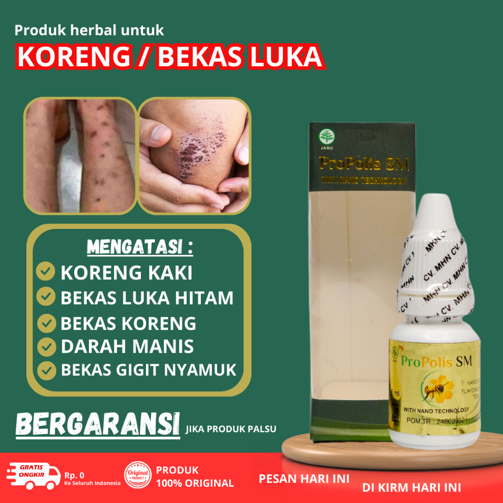 Jual Obat Korengan di kaki - Obat Borok di kaki - Obat Budug / Budugan ...
