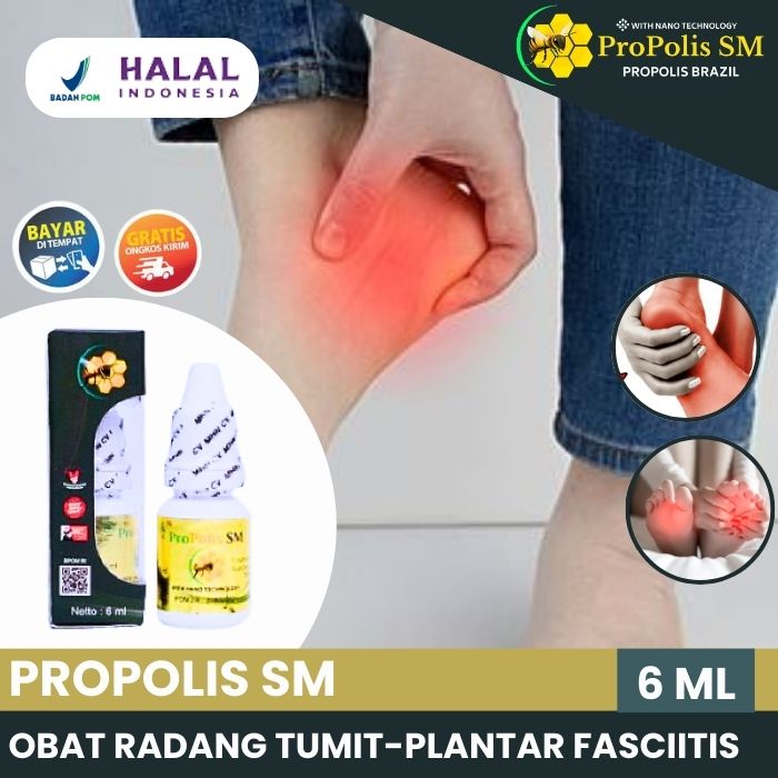 Jual Obat Radang Tumit Nyeri Plantar Fasciitis Sakit Kaki Sebelah Kiri ...