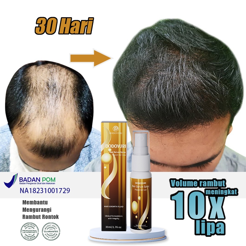 Jual [BPOM] DODOYURI Serum penumbuh rambut Penumbuh rambut botak Hair ...