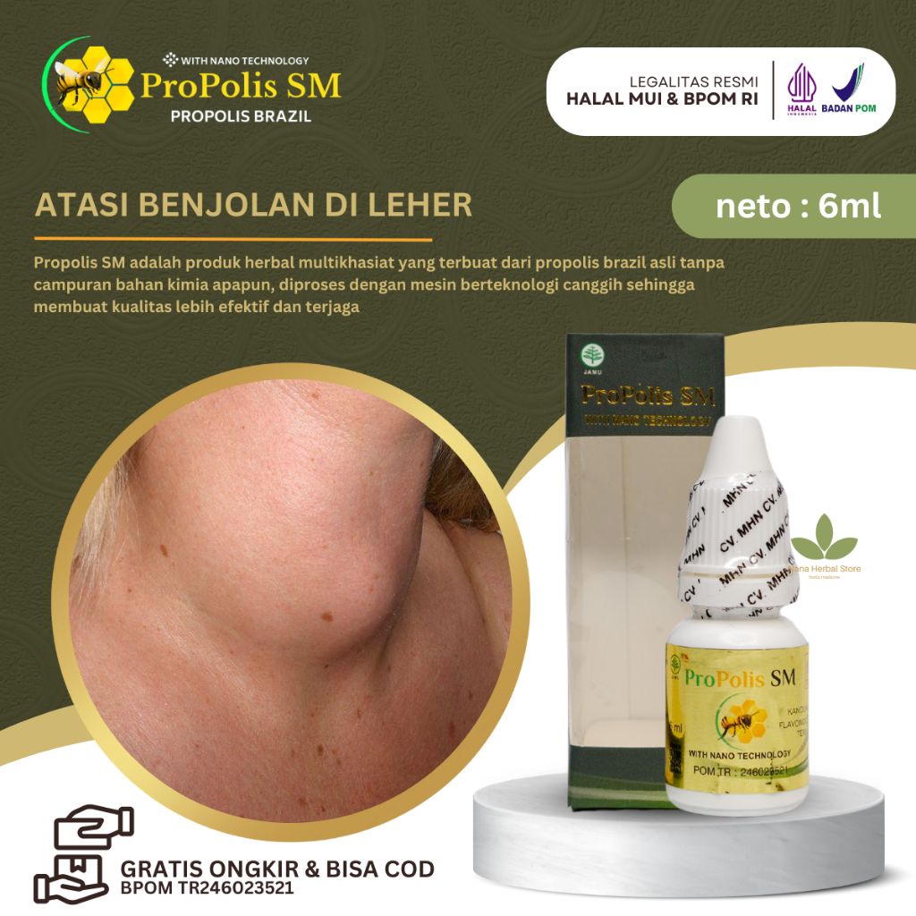 Jual Propolis SM 6ml Obat Benjolan Di leher Lipoma Kelenjar Getah ...