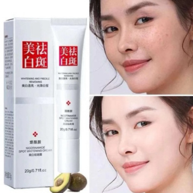 Jual FUYAN Whitening Freckle Cream Remove Dark Spots Anti Freckle Niacinamide Pelembab Flek ...