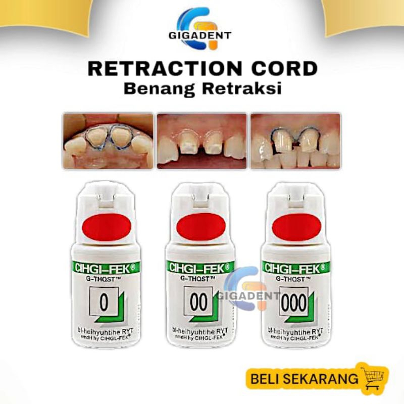 Jual RECTRACTION CORD BENANG RETRAKSI | Shopee Indonesia