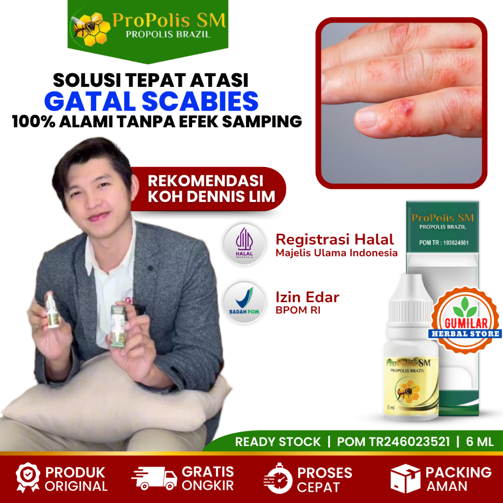 Jual OBAT TETES GATAL SCABIES PADA MANUSIA - OBAT SCABIES GATAL GUDIK ...