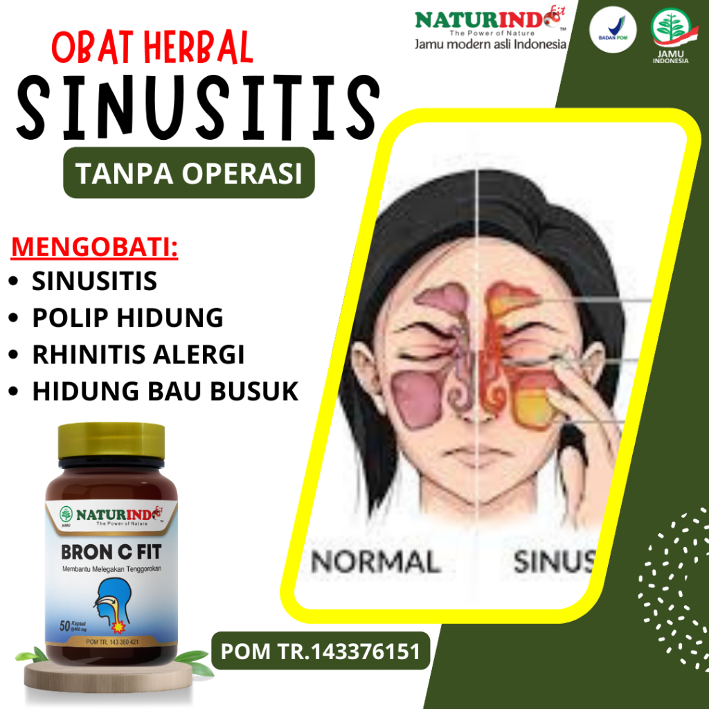 Jual Obat Sinusitis Polip Hidung Rhinitis Alergi Kronis Akut Pilek ...