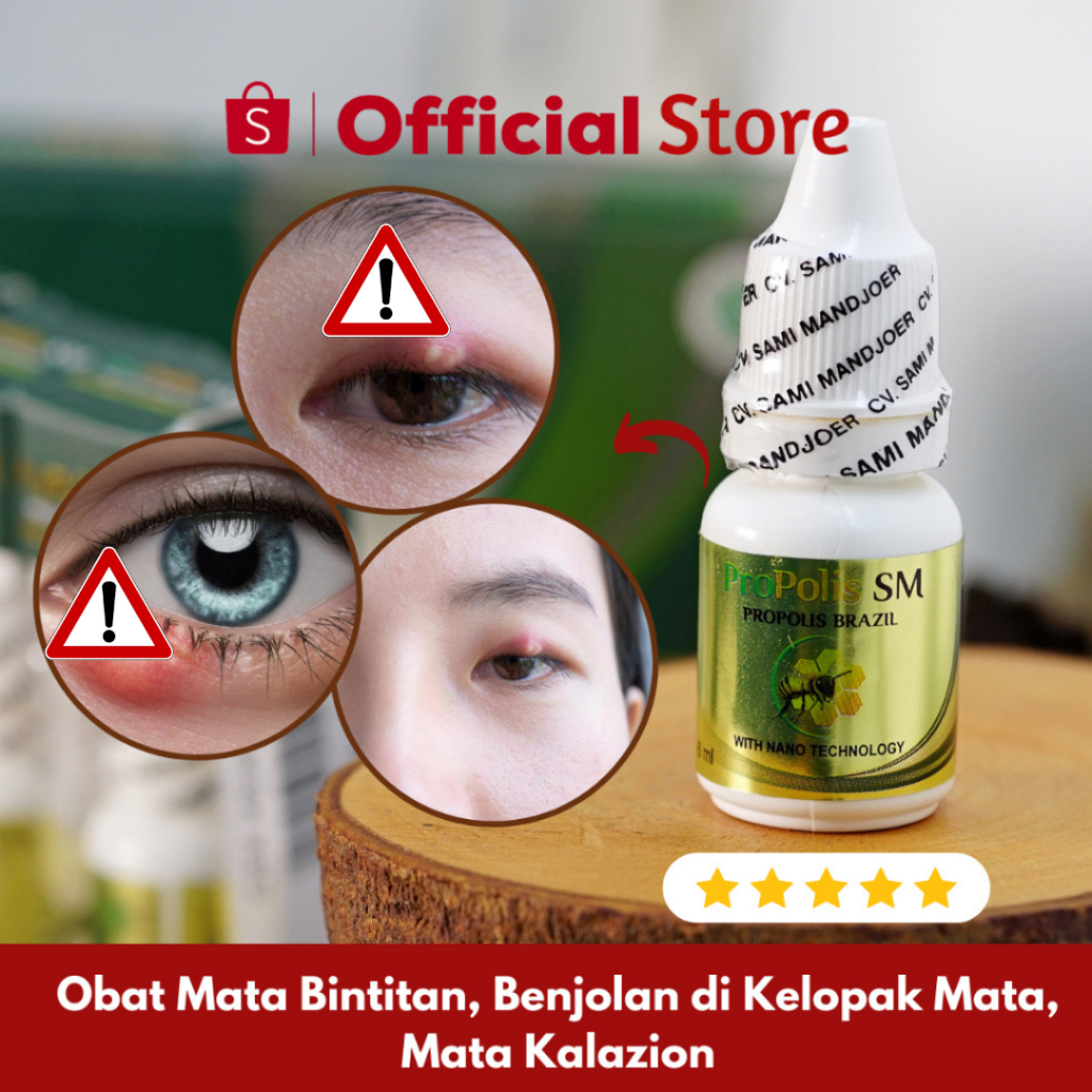 Jual Obat Mata Bintitan Benjolan di Kelopak Mata Mata Kalazion Mata ...