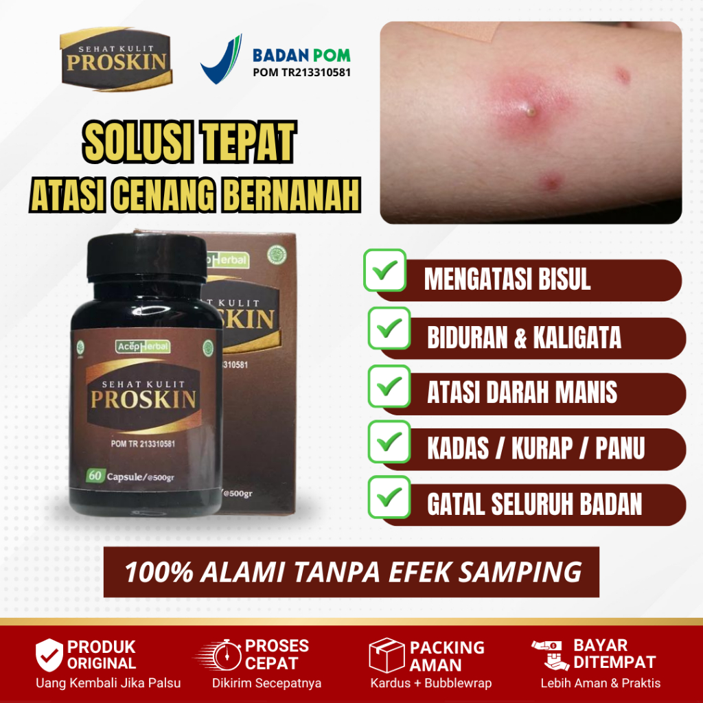 Jual Obat Cenang Bernanah / Benjolan Bernanah, Gatal Bernanah, Bintik ...