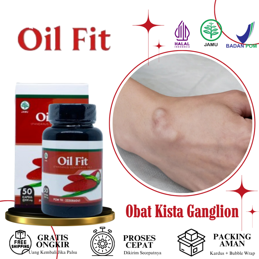 Jual Oil Fit - Obat Benjolan Di Tangan, Obat Kista Ganglion, Obat ...