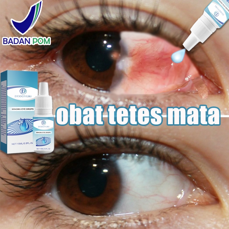 Jual Obat tetes mata Obat mata Obat mata katarak obat katarak 15ml Mata ...