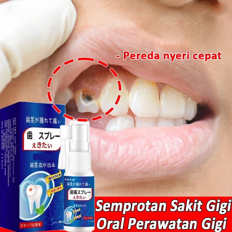 Jual Obat Sakit Gigi Paling Ampuh Semprotan Pereda Nyeri Sakit Gigi ...