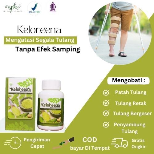 Jual Obat Penyembuh Patah Tulang, Tulang Retak, Tulang Remuk, Tulang ...