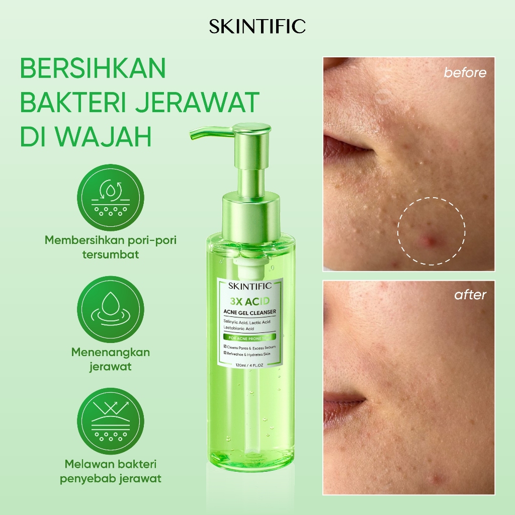 Jual [New Launch] SKINTIFIC - 3X Acid Acne Gel Cleanser 120ml ...