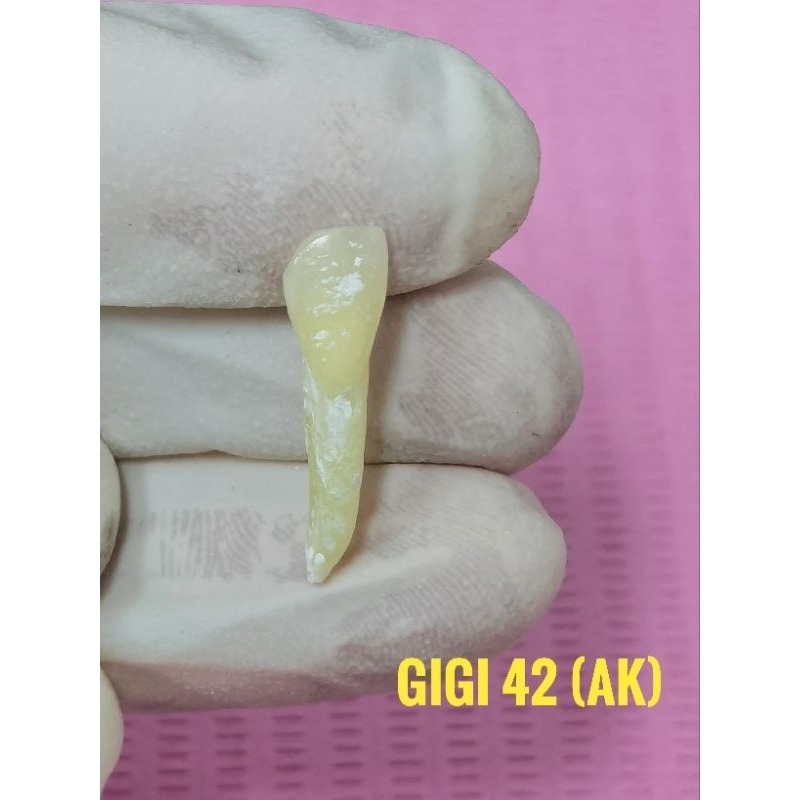 Jual gigi 42 : gigi insisif 2 bawah kanan | Shopee Indonesia