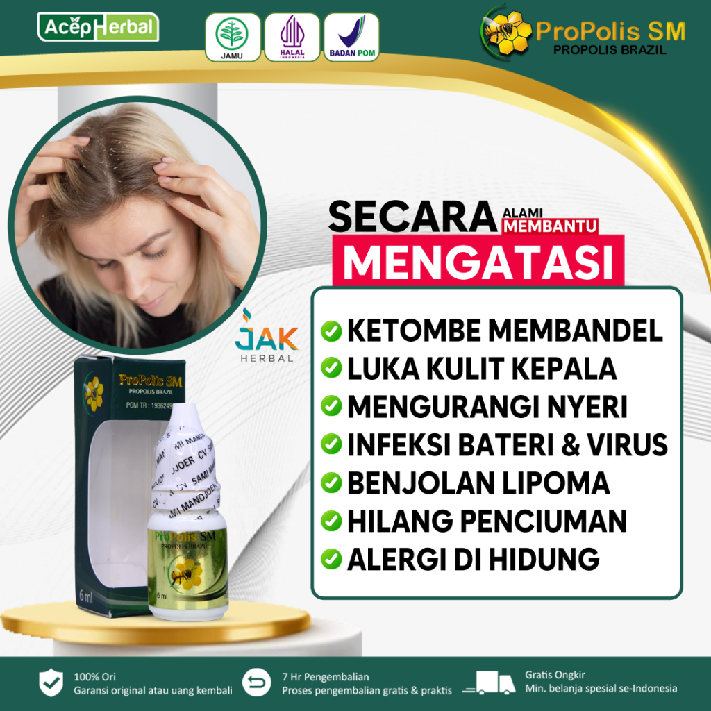 Jual Obat Ketombe Membandel, Ketombe Berkerak, Kulit Kepala Koreng, Kulit Kepala Bersisik ...