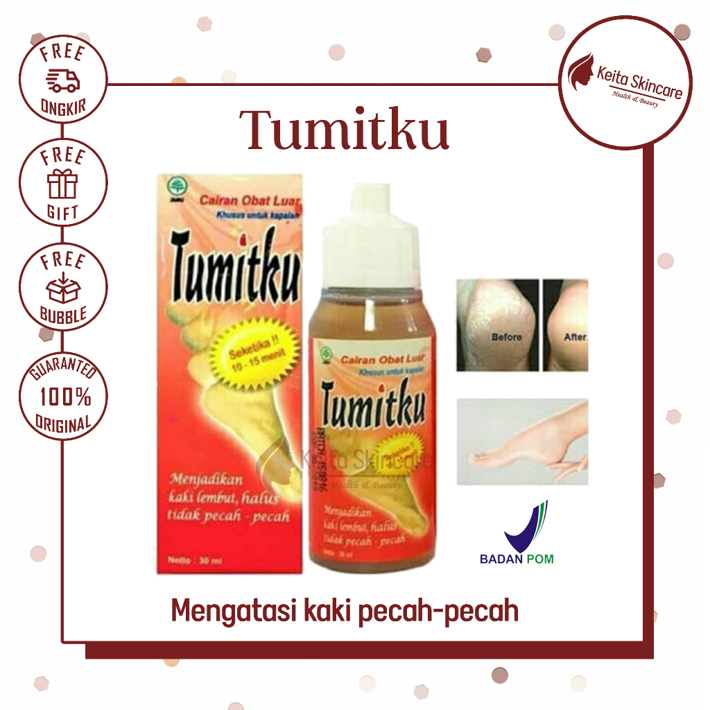 Jual TUMITKU Obat Herbal Kaki Pecah & Kering Penghalus Tumit Kaki ...