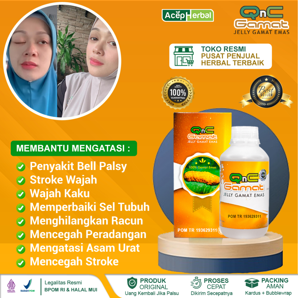 Jual Obat Bells Palsy Syaraf Wajah Kaku Wajah Kaku Susah Bicara Stroke ...