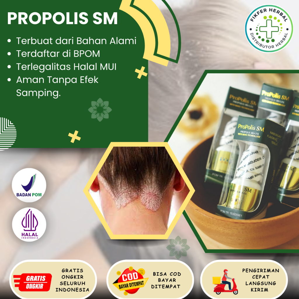 Jual Obat Gatal Kepala, Koreng di Kepala, Obat Kepala Berjamur, Kulit Kepala Borok, Bersisik ...