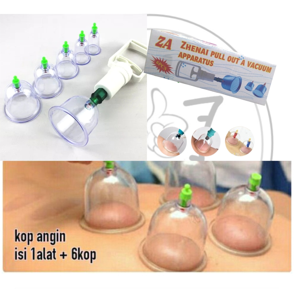 Jual Kop Angin Bekam / Alat Bekam Lengkap Kongsui Isi 6 Tabung - Alat Cop Masuk Angin Cupping ...