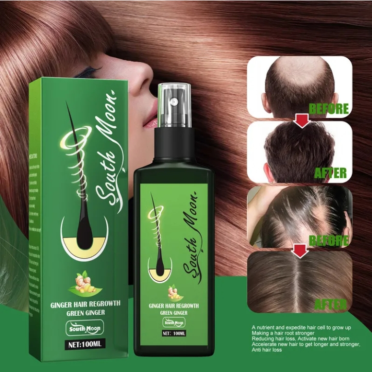 Jual South Moon semprotan perawatan pertumbuhan rambut-Hair nutrition ...