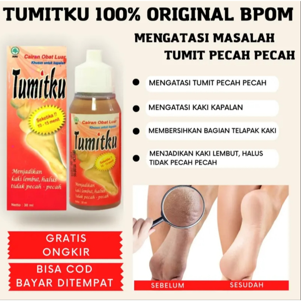 Jual {NEW Produk} TUMITKU OBAT KAKI PECAH Original BPOM Solusi Kaki ...